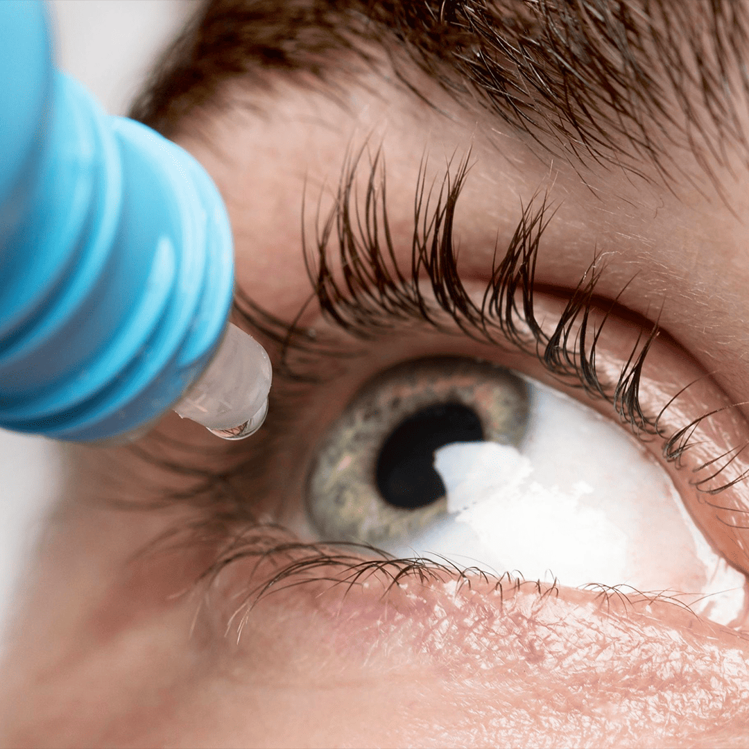 Tutto quello che devi sapere sulle gocce oculari - Spegetti Ottica